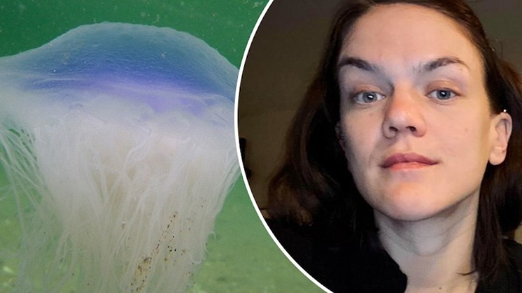 Blå brännmaneter har intagit Västkusten: ”Mer av dem än vanligt” - P4 ...